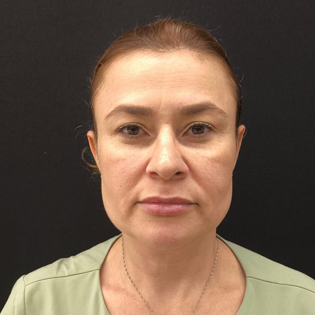 Lista de espera – OJESH